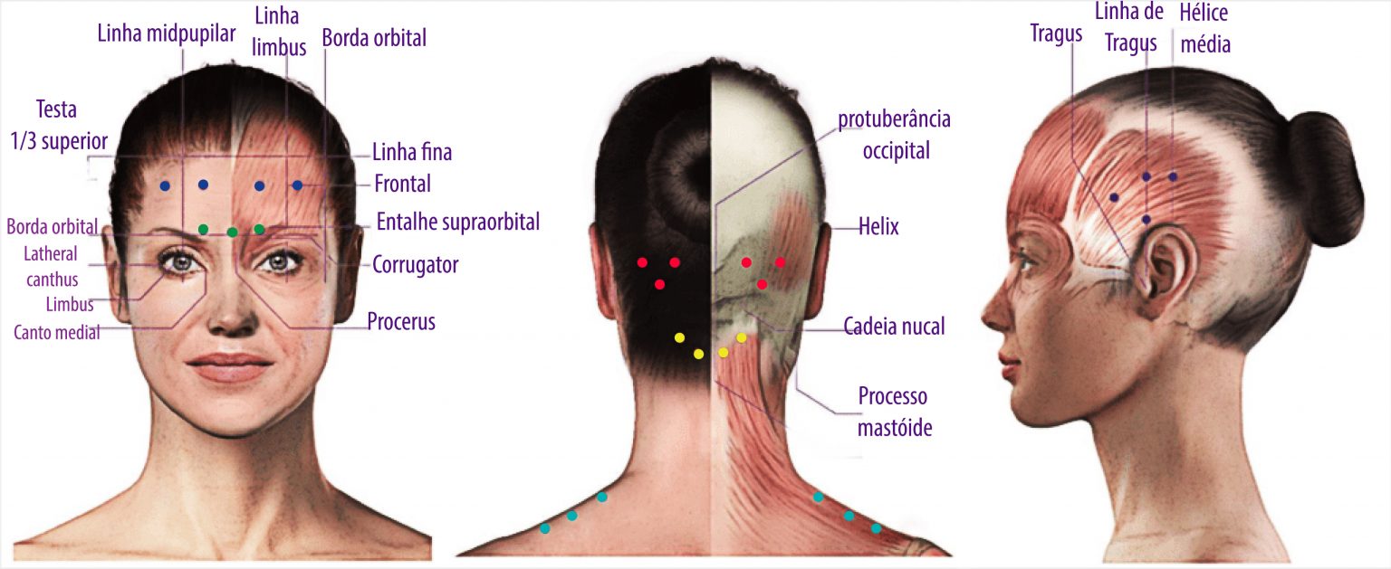 Toxina Botulínica Terapêutica - Clínica Regenerati - Neurologia